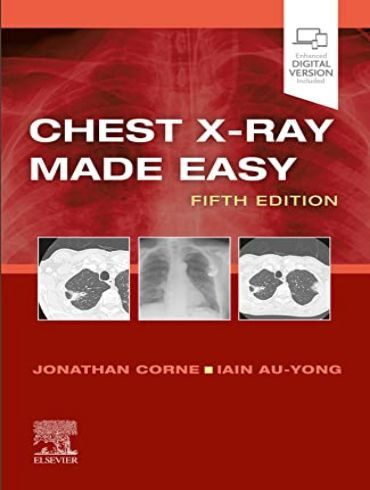 دانلود كتاب Chest X-Ray Made Easy 5th Edition – medPDF