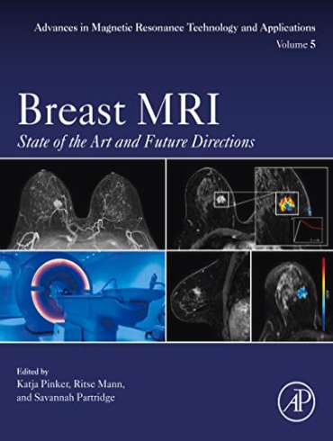 دانلود كتاب Breast MRI: State of the Art and Future Directions 1st ...