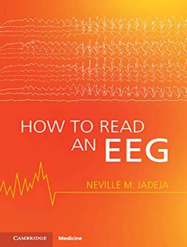 دانلود کتاب How to Read an EEG 1st Edition – medPDF