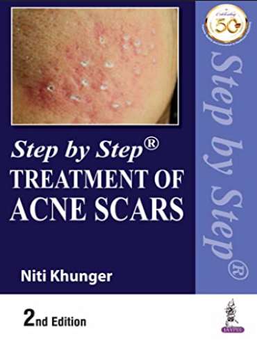 دانلود كتاب Step by Step Treatment of Acne Scars 2nd Edition – medPDF