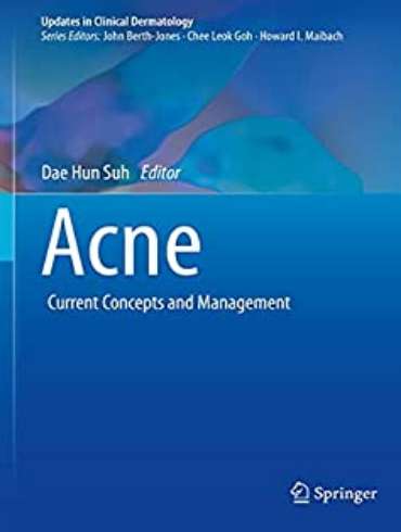 دانلود كتاب Acne: Current Concepts and Management 1st Edition – medPDF