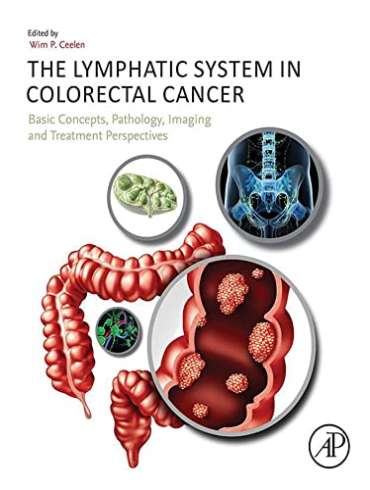 دانلود كتاب The Lymphatic System in Colorectal Cancer: Basic Concepts ...