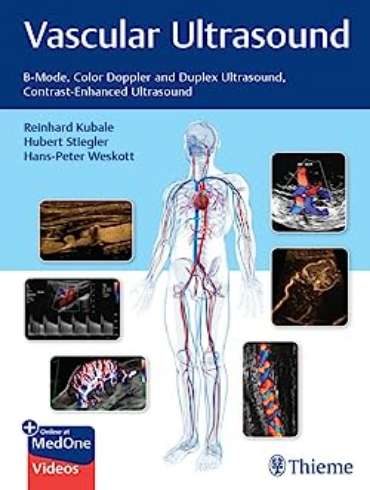 دانلود کتاب Vascular Ultrasound: B-Mode, Color Doppler and Duplex ...