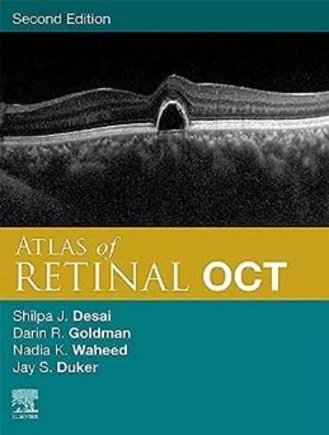 دانلود کتاب Atlas of Retinal OCT: Optical Coherence Tomography 2nd ...