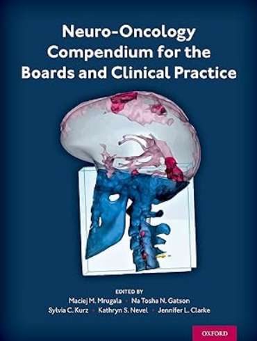 دانلود Neuro-Oncology Compendium for the Boards – medPDF