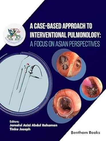 دانلود کتاب Diagnostic and Interventional Bronchoscopy in Children 1st ...