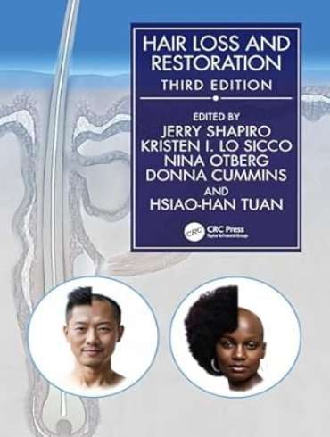 دانلود کتاب Hair Loss and Restoration 3rd Edition – medPDF