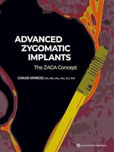 دانلود کتاب Advanced Zygomatic Implants: The Zaga Concept 1st Edition ...