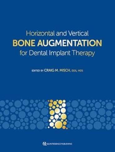 کتاب Horizontal and Vertical Bone Augmentation for Dental Implant ...
