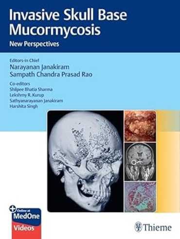 دانلود کتاب Invasive Skull Base Mucormycosis: New Perspectives + Video ...