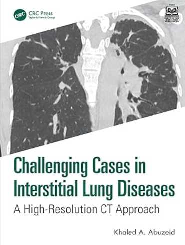 دانلود کتاب Challenging Cases in Interstitial Lung Diseases – medPDF