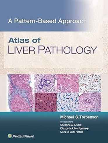 دانلود كتاب Atlas of Liver Pathology: A Pattern-Based Approach 1st Edition – medPDF