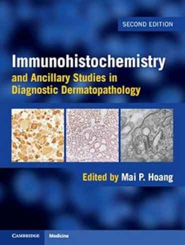 دانلود Immunohistochemistry and Ancillary Studies in Diagnostic ...