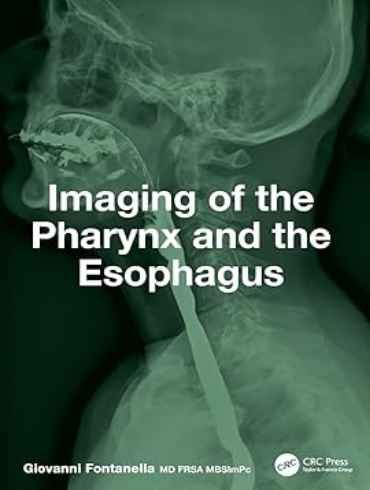 دانلود کتاب Imaging of the Pharynx and the Esophagus 1st Edition – medPDF